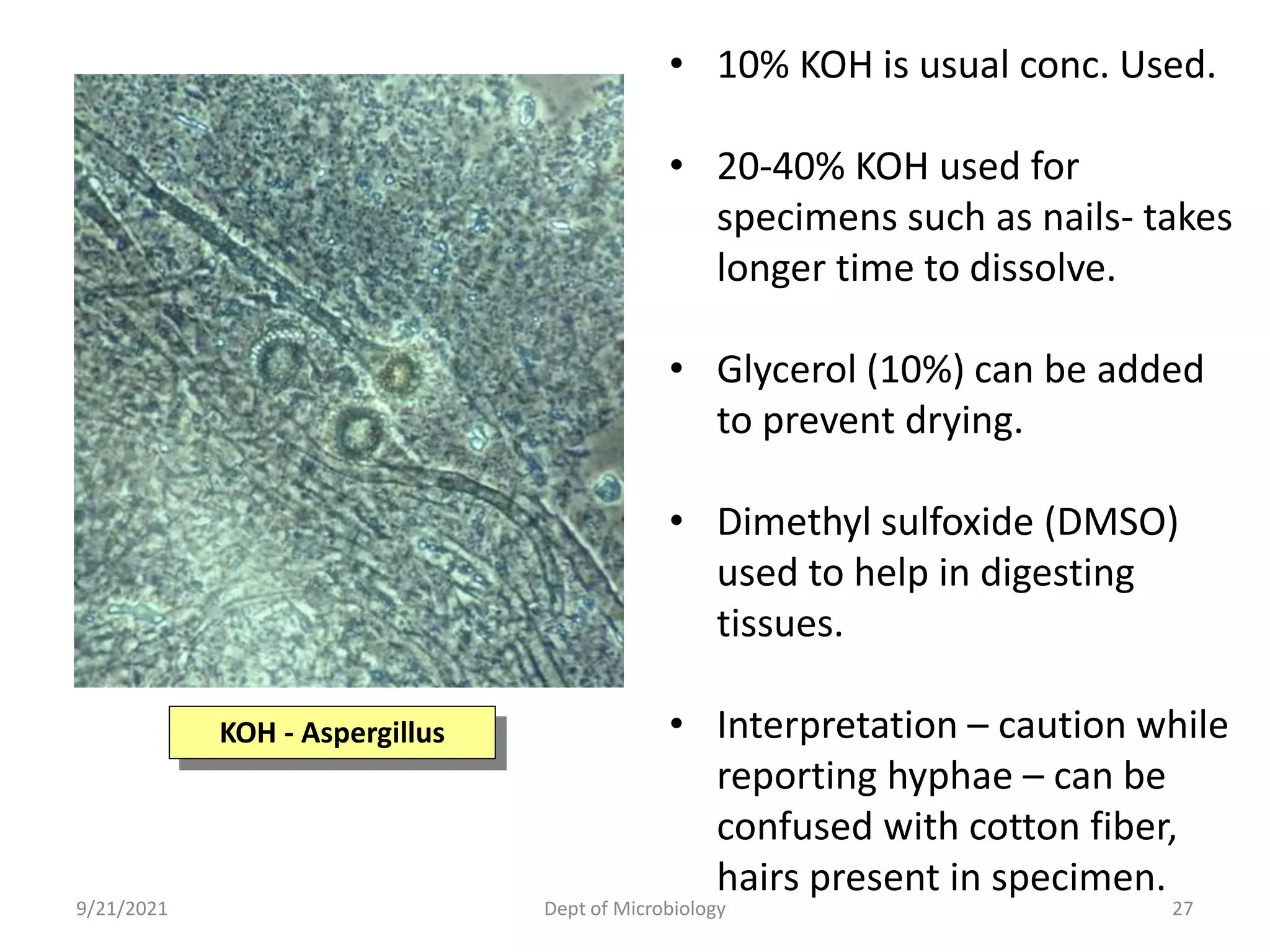 Laboratory diagnosis of mycology microscopy, staining techniques ...