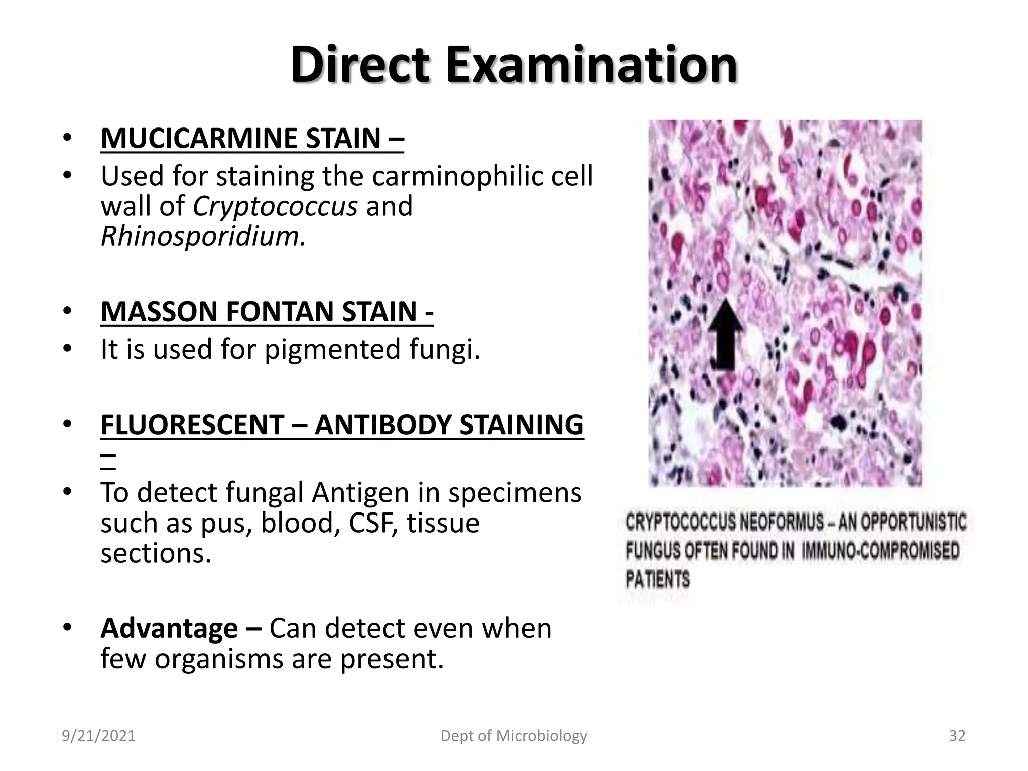Laboratory diagnosis of mycology microscopy, staining techniques ...