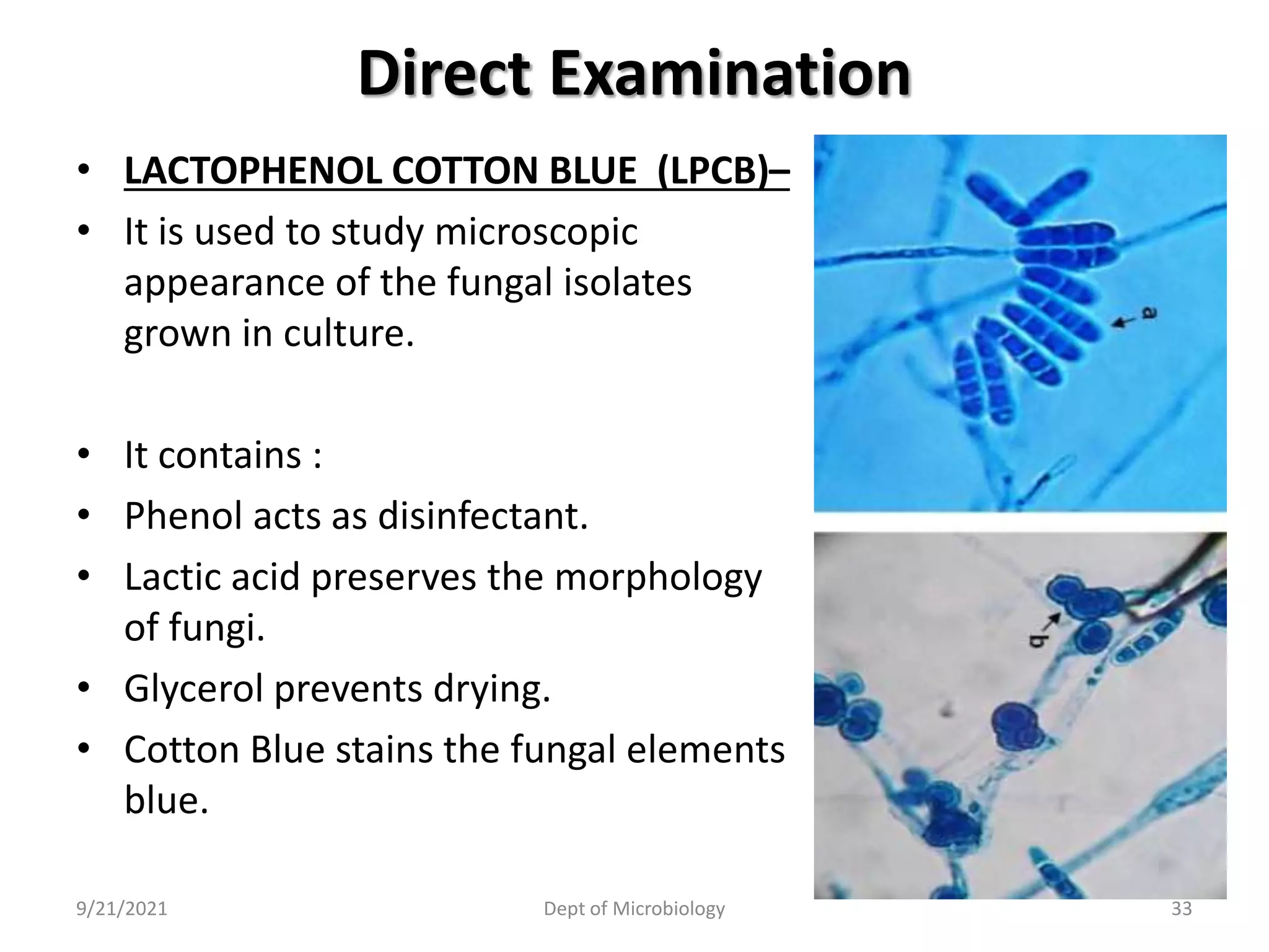 Laboratory diagnosis of mycology microscopy, staining techniques ...