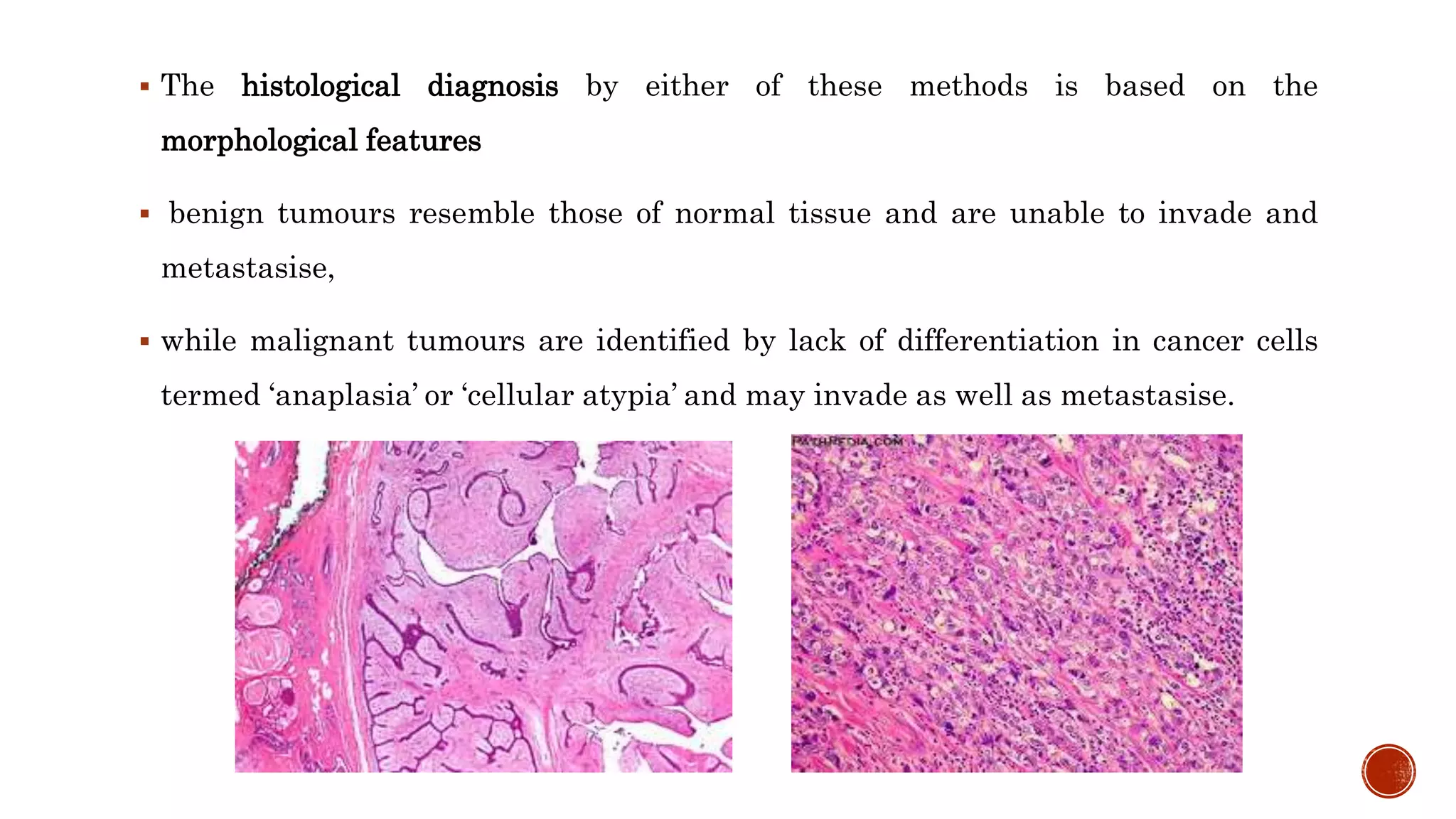 Laboratory diagnosis of neoplasm | PPTX