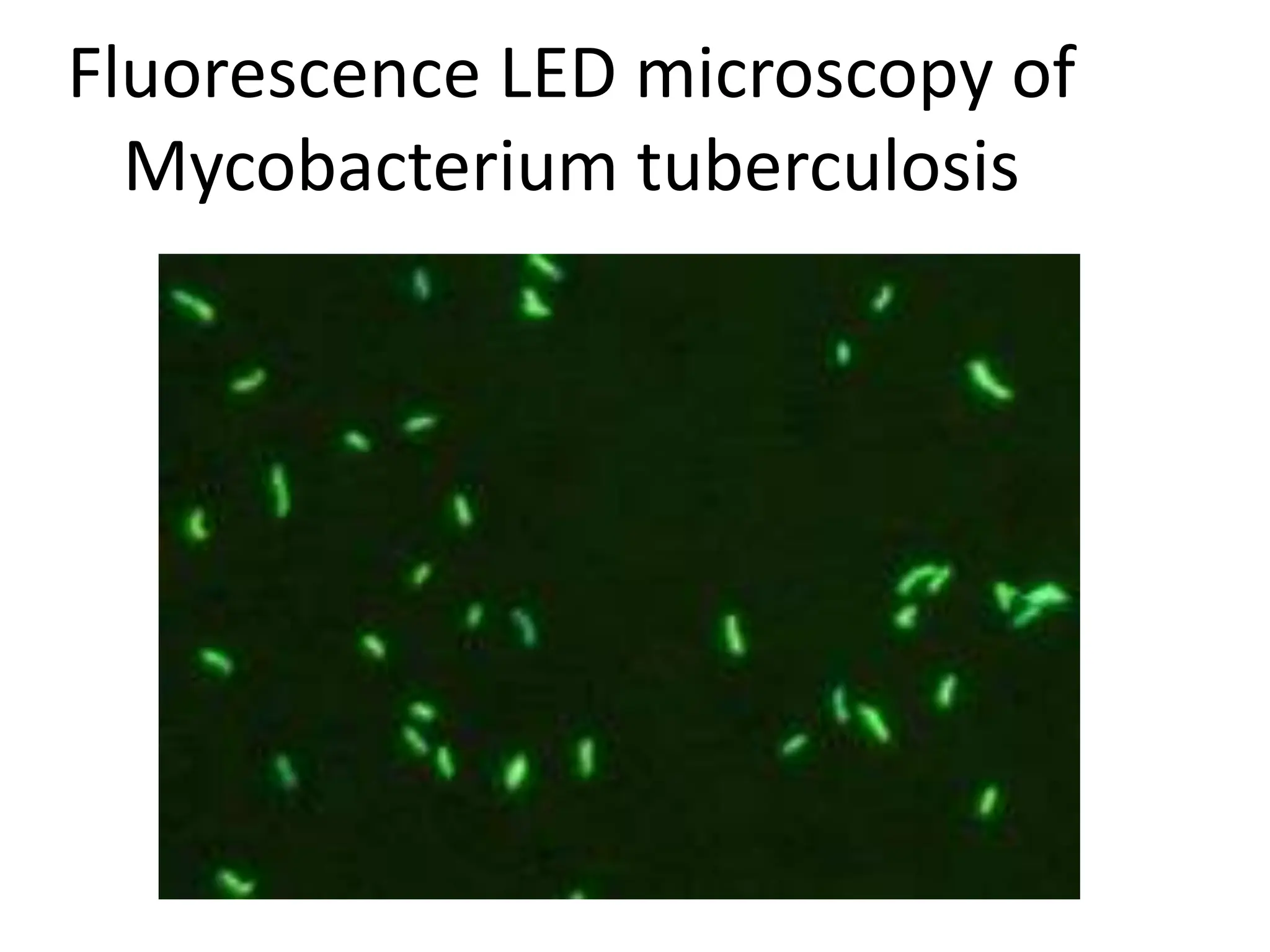 Laboratory diagnosis of pulmonary TB .ppt