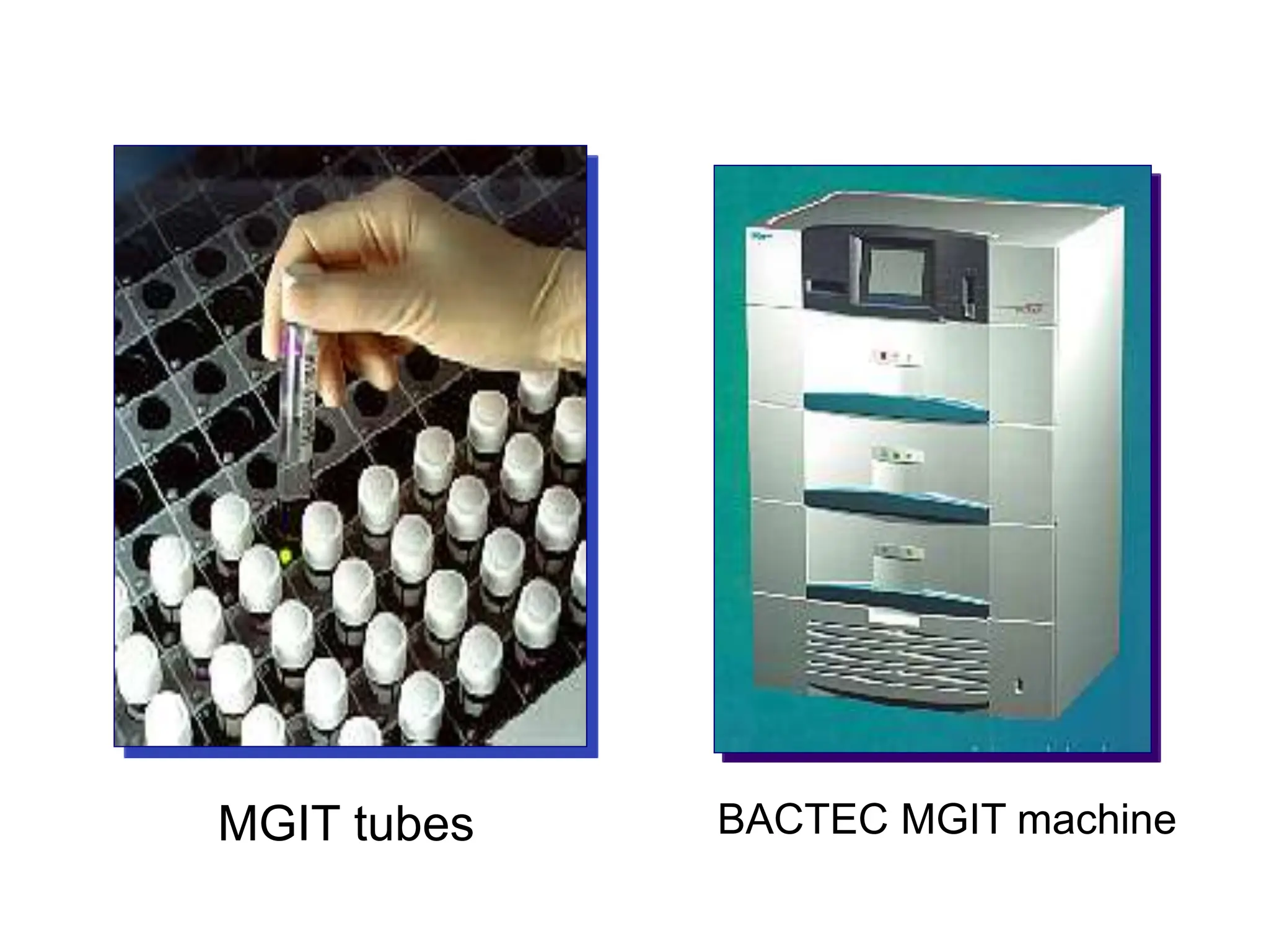 Laboratory diagnosis of pulmonary TB .ppt