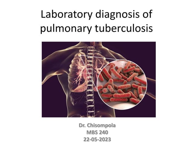 Laboratory Diagnosis Of Pulmonary Tb Ppt