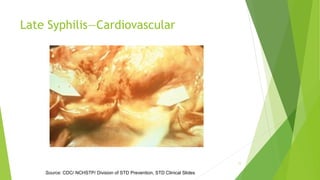 Laboratory diagnosis of syphilis | PPTX