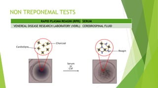 Laboratory diagnosis of syphilis | PPTX