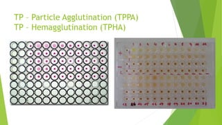 Laboratory diagnosis of syphilis | PPTX
