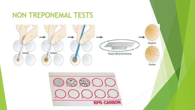 Laboratory diagnosis of syphilis