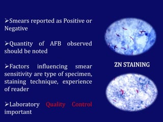 Laboratory diagnosis of Tuberculosis | PPTX