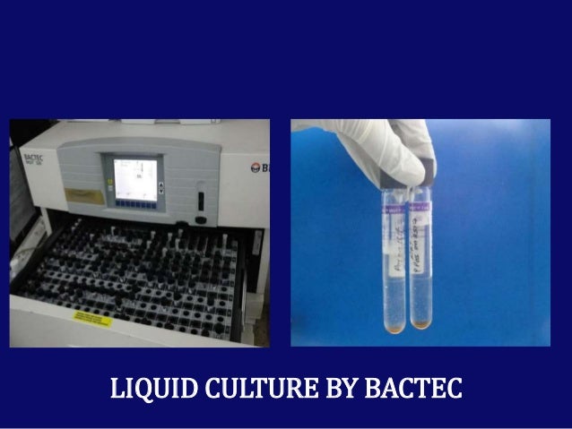 Laboratory diagnosis of Tuberculosis