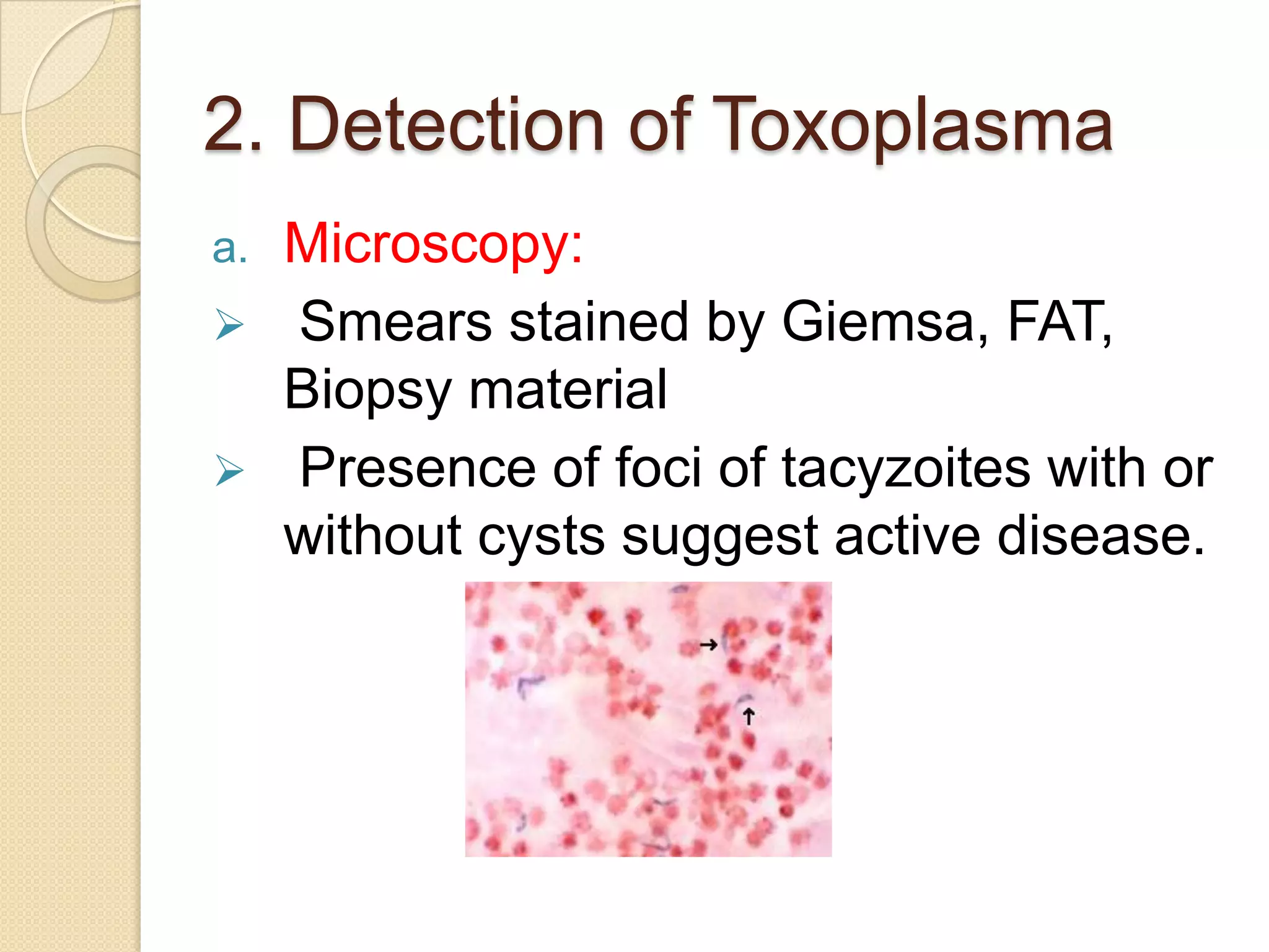 Laboratory diagnosis of toxoplasmosis | PPTX