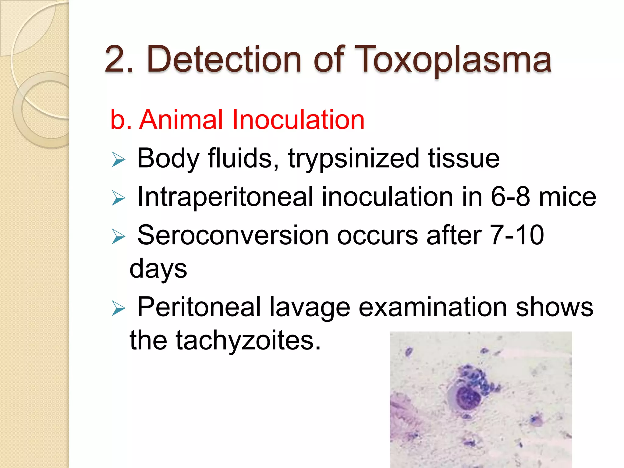 Laboratory diagnosis of toxoplasmosis | PPTX