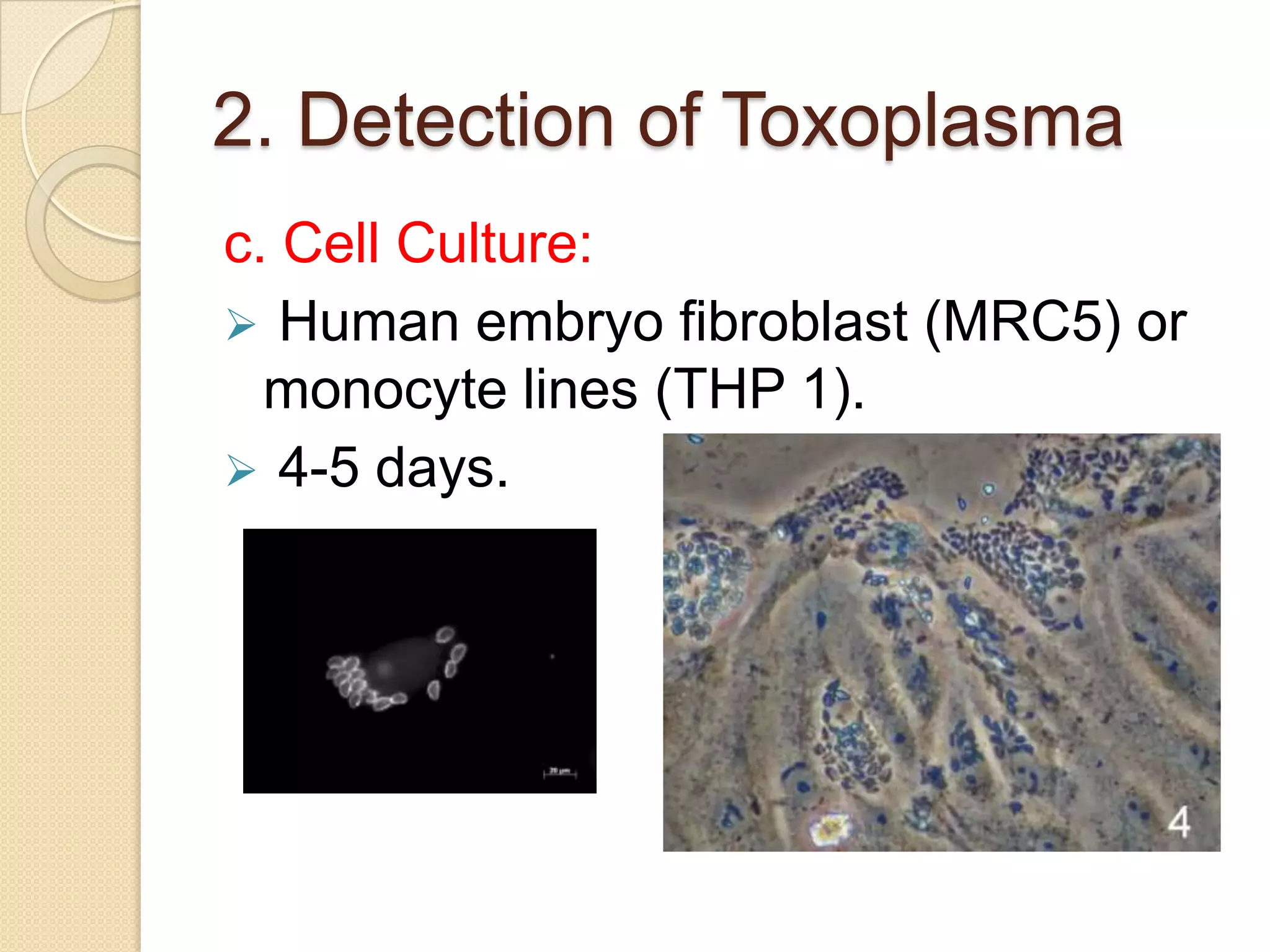 Laboratory diagnosis of toxoplasmosis | PPTX