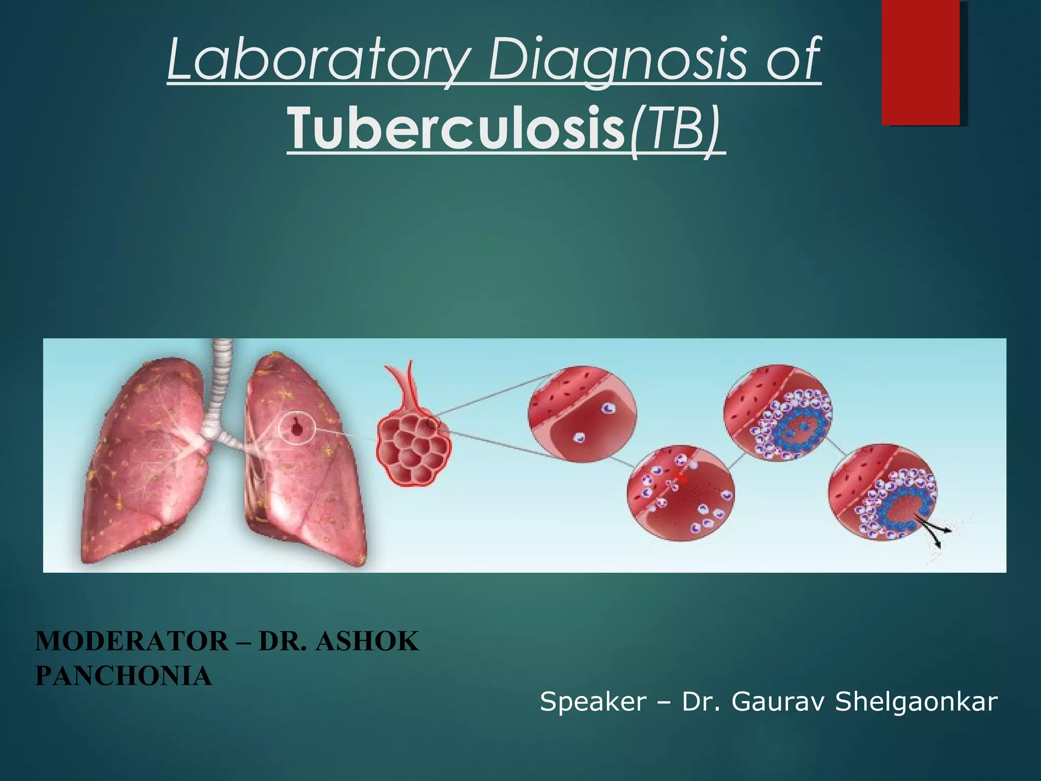 Laboratory diagnosis of Tuberculosis gs | PPT