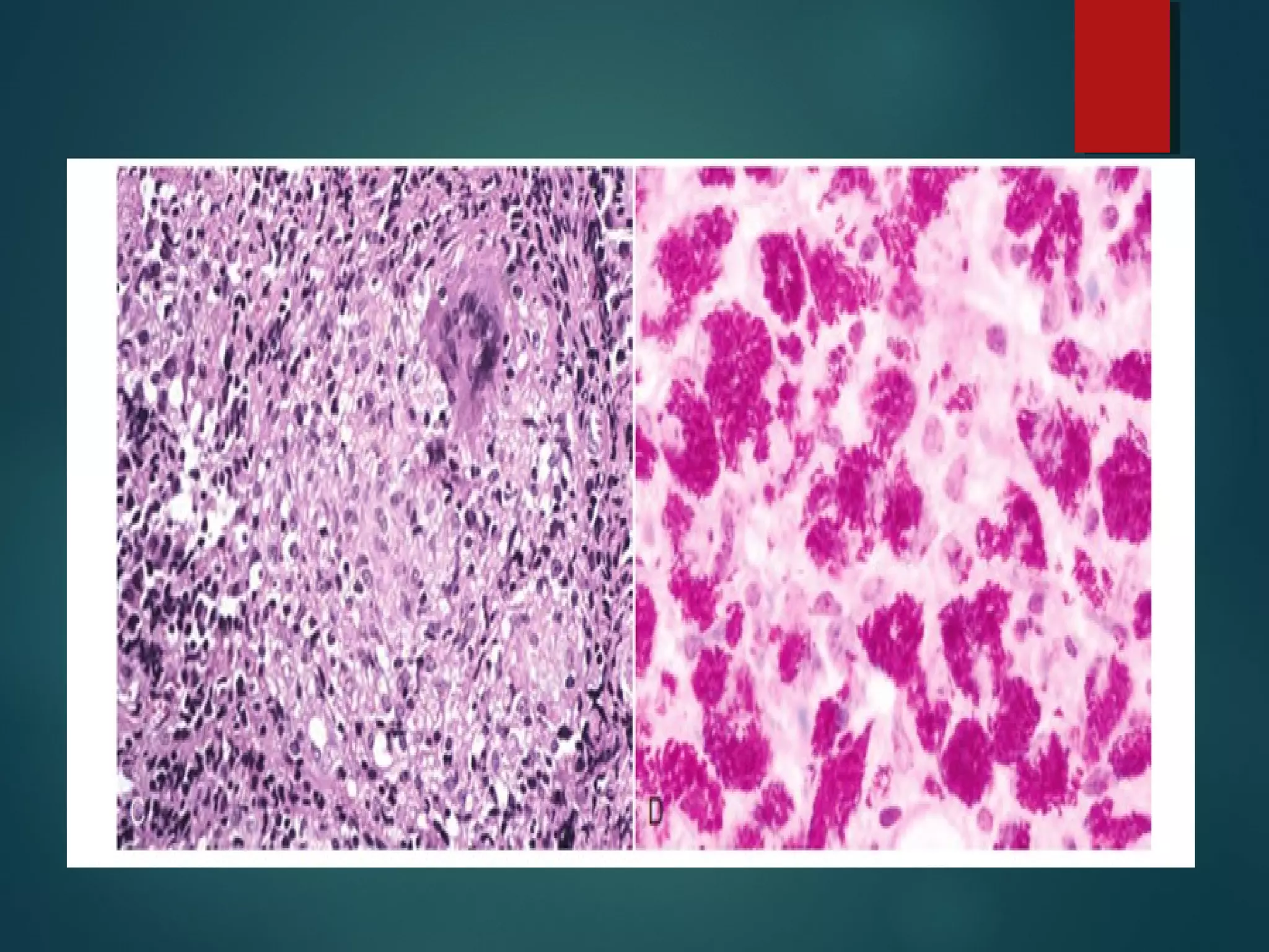 Laboratory diagnosis of Tuberculosis gs | PPT