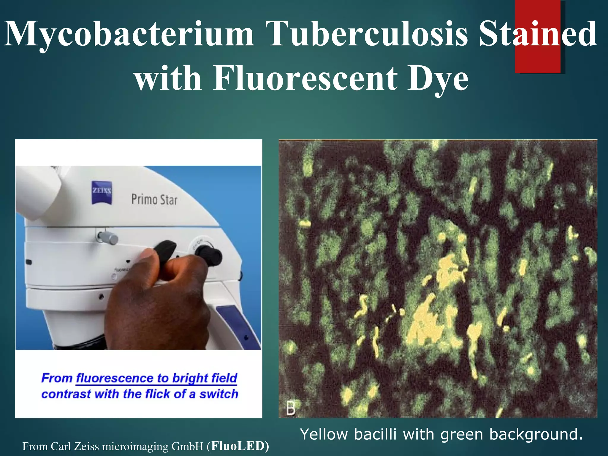 Laboratory diagnosis of Tuberculosis gs | PPT