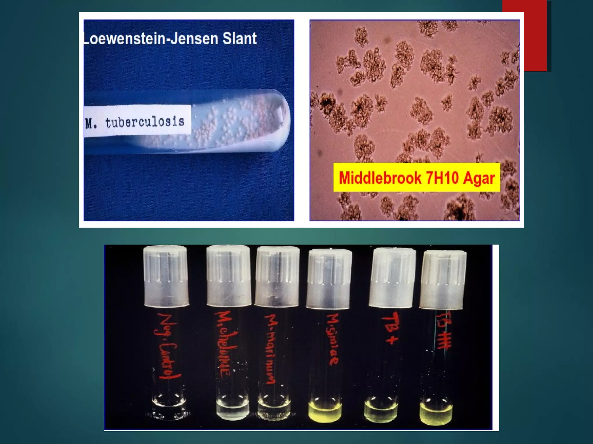 Laboratory diagnosis of Tuberculosis gs | PPT