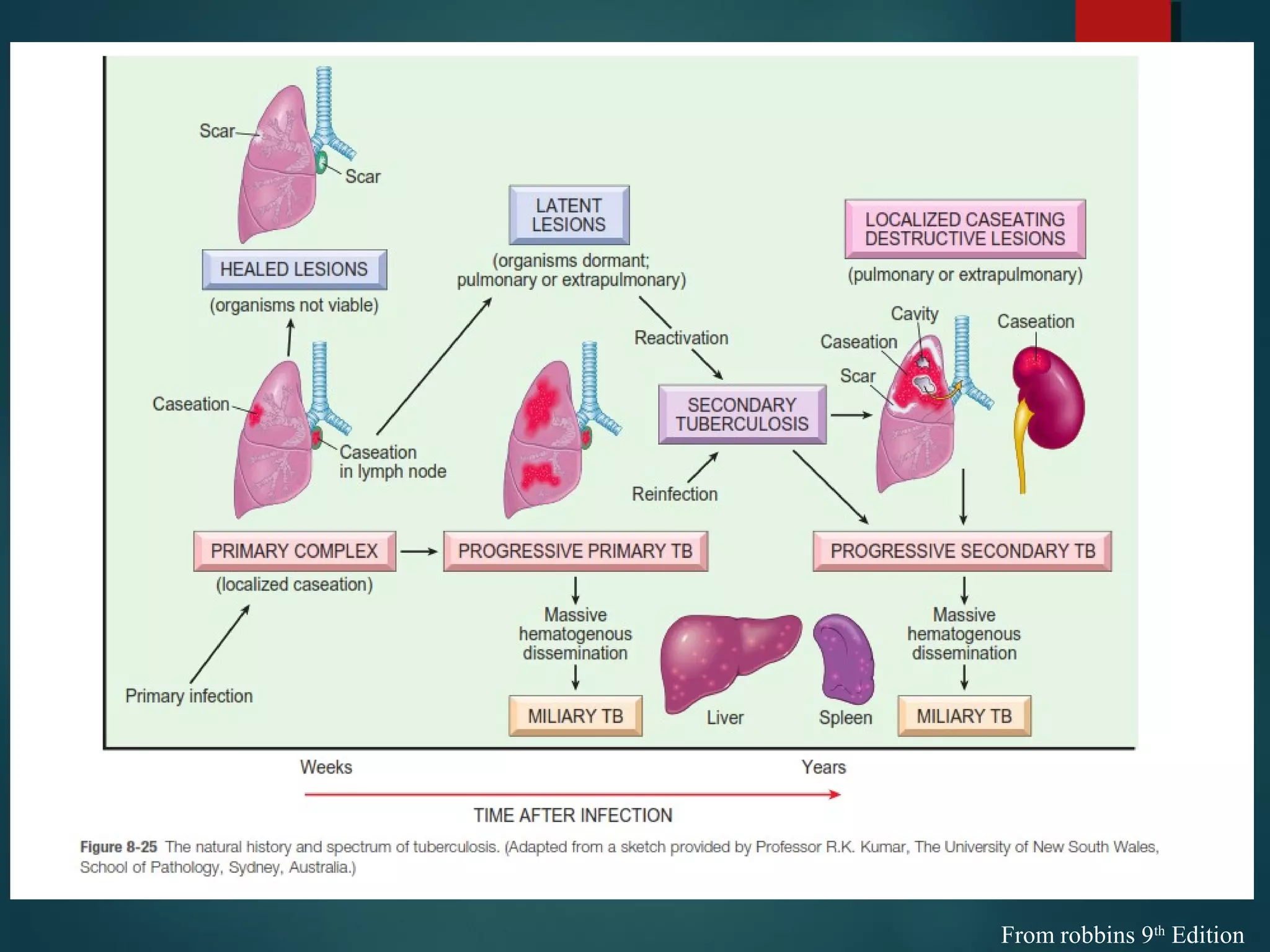 Laboratory diagnosis of Tuberculosis gs | PPT