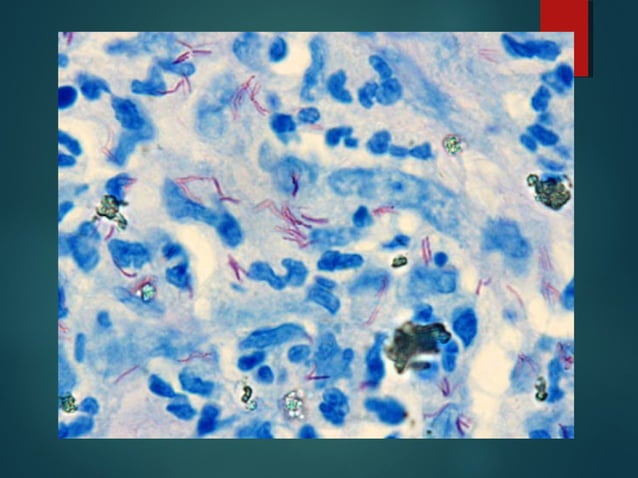 Laboratory diagnosis of Tuberculosis gs | PPT | Lung and Respiratory ...