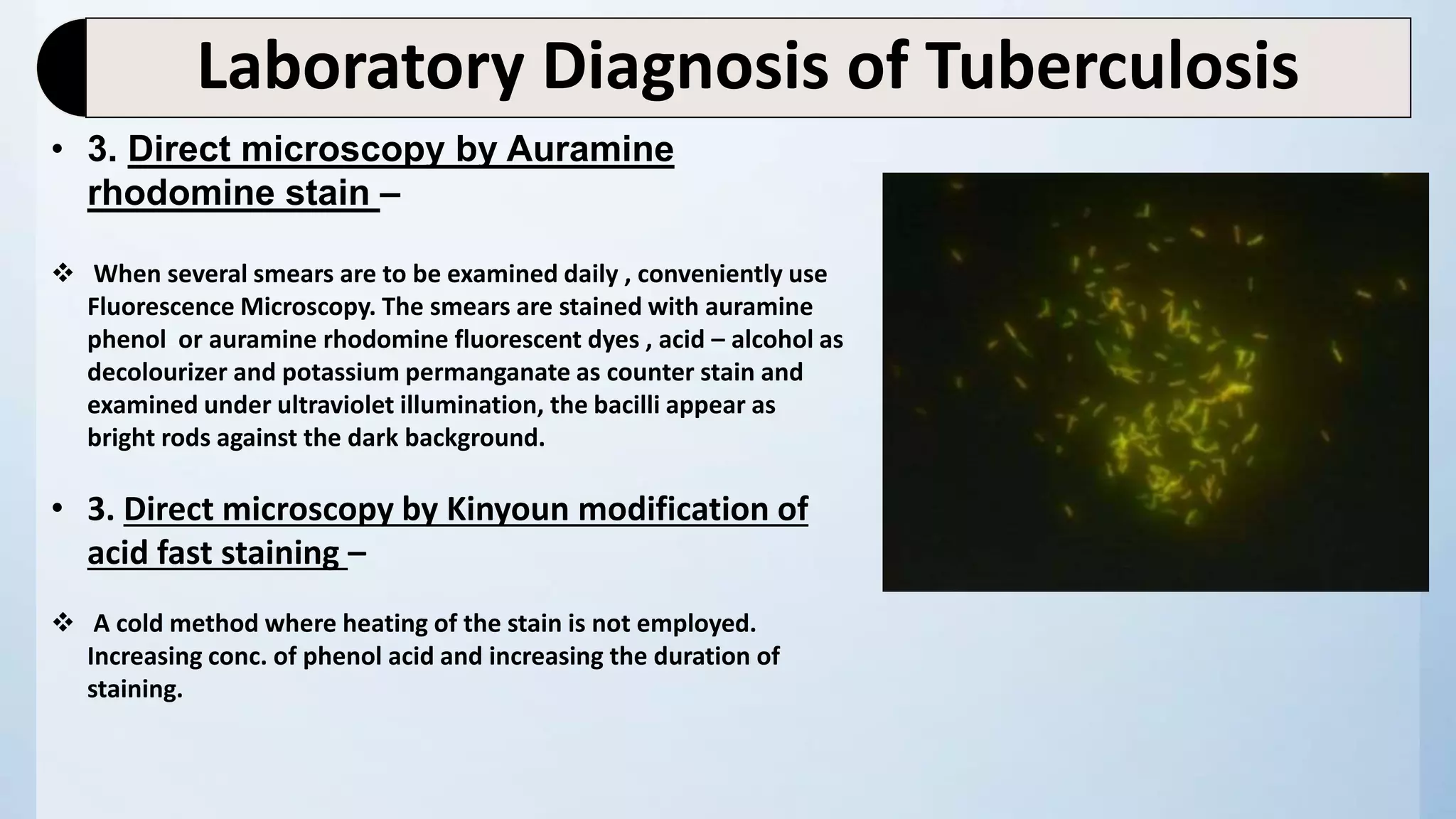 Laboratory diagnosis of tuberculosis pract. | PPTX