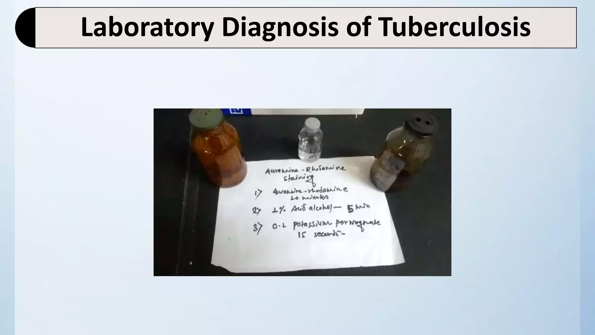 Laboratory diagnosis of tuberculosis pract. | PPTX