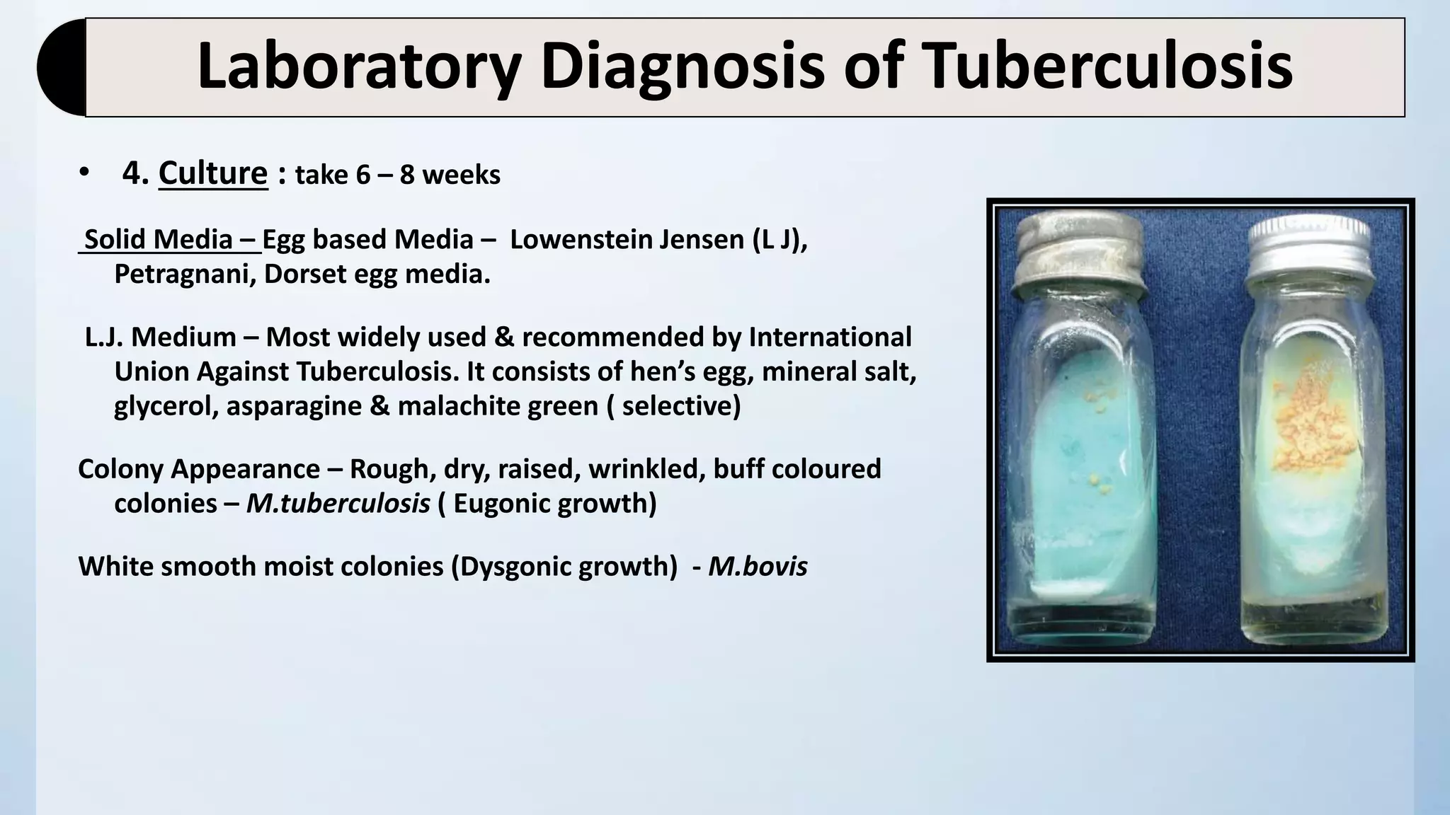 Laboratory diagnosis of tuberculosis pract. | PPTX