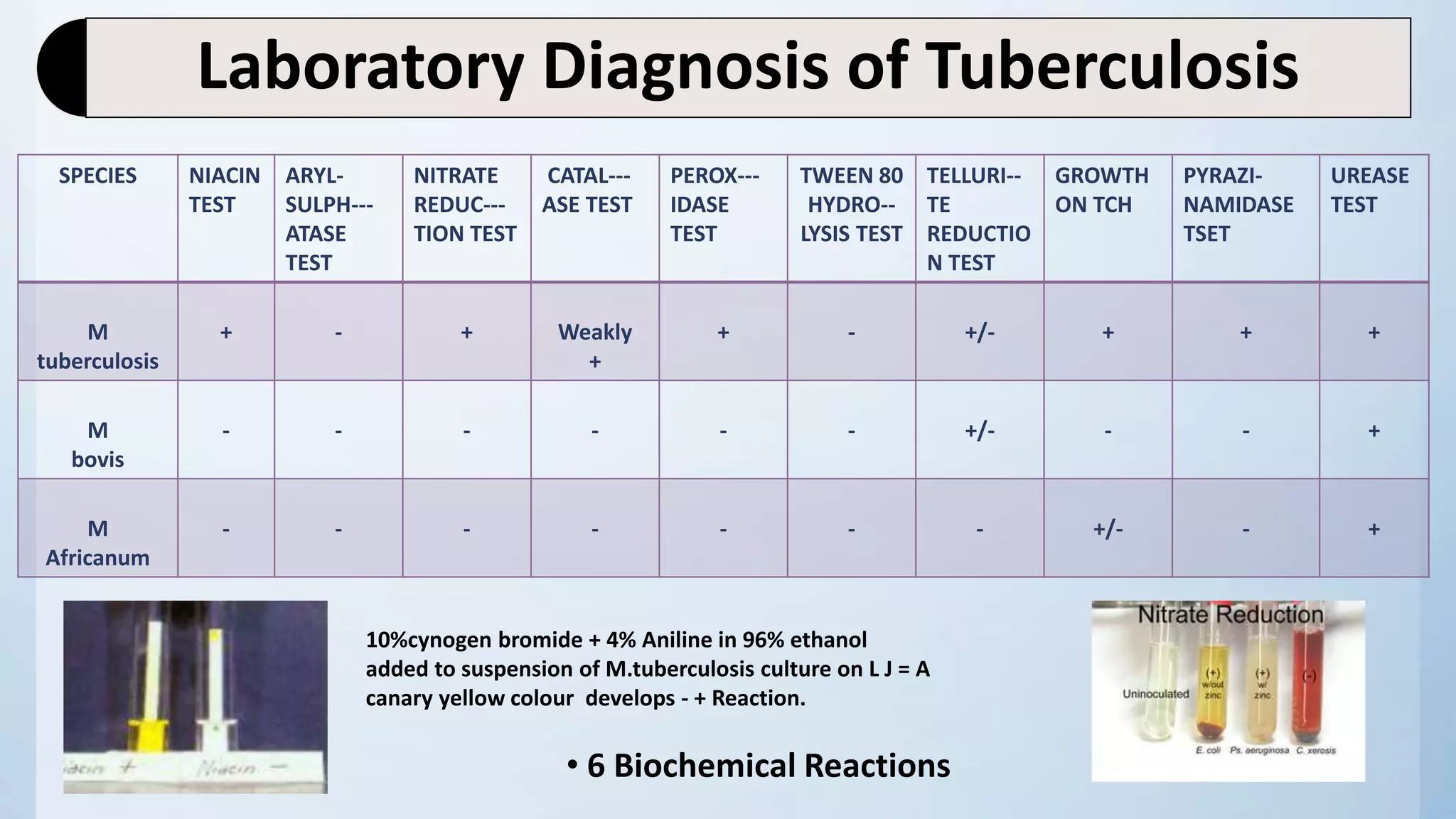 Laboratory diagnosis of tuberculosis pract. | PPTX