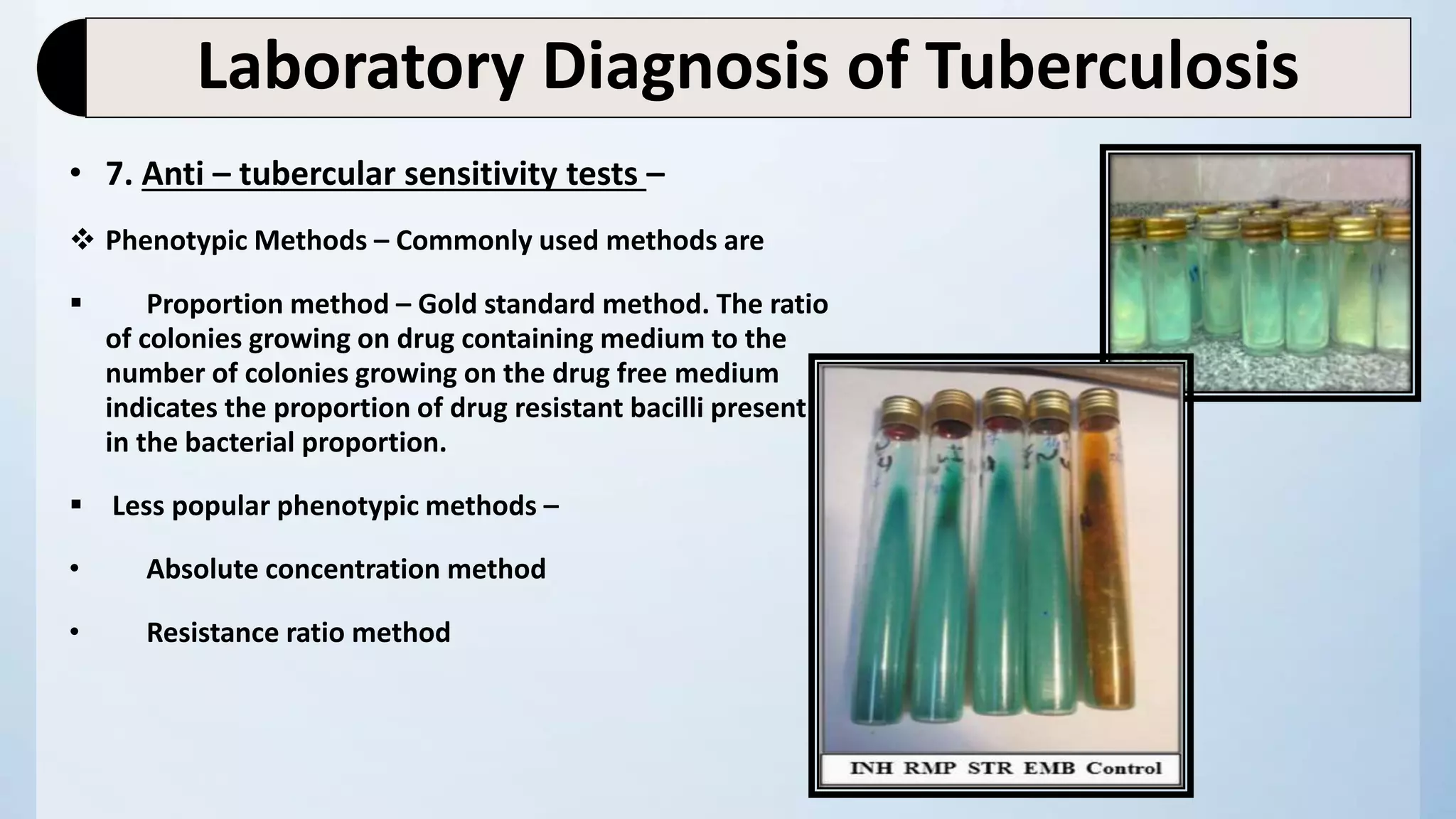 Laboratory diagnosis of tuberculosis pract. | PPTX