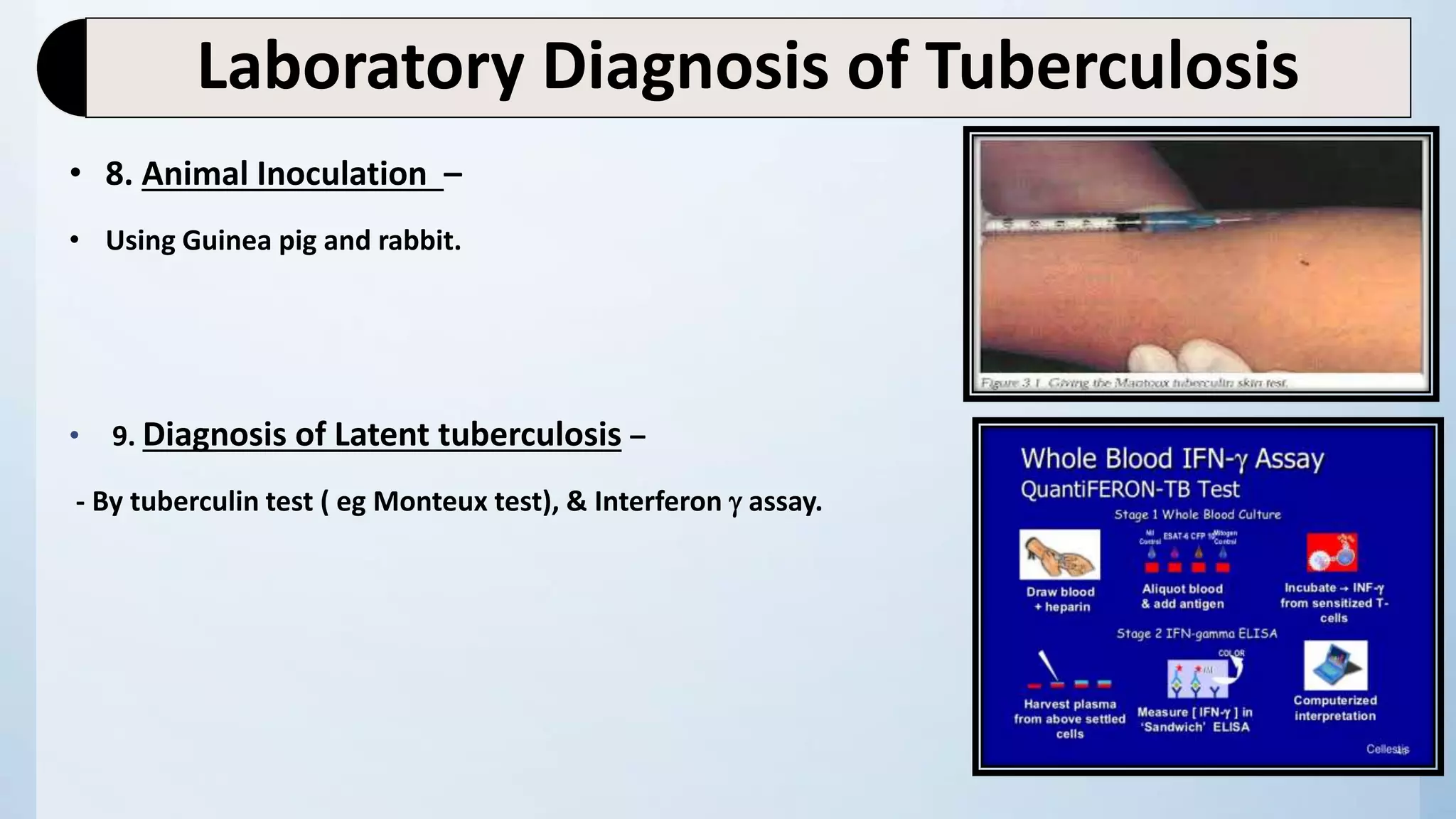 Laboratory diagnosis of tuberculosis pract. | PPTX