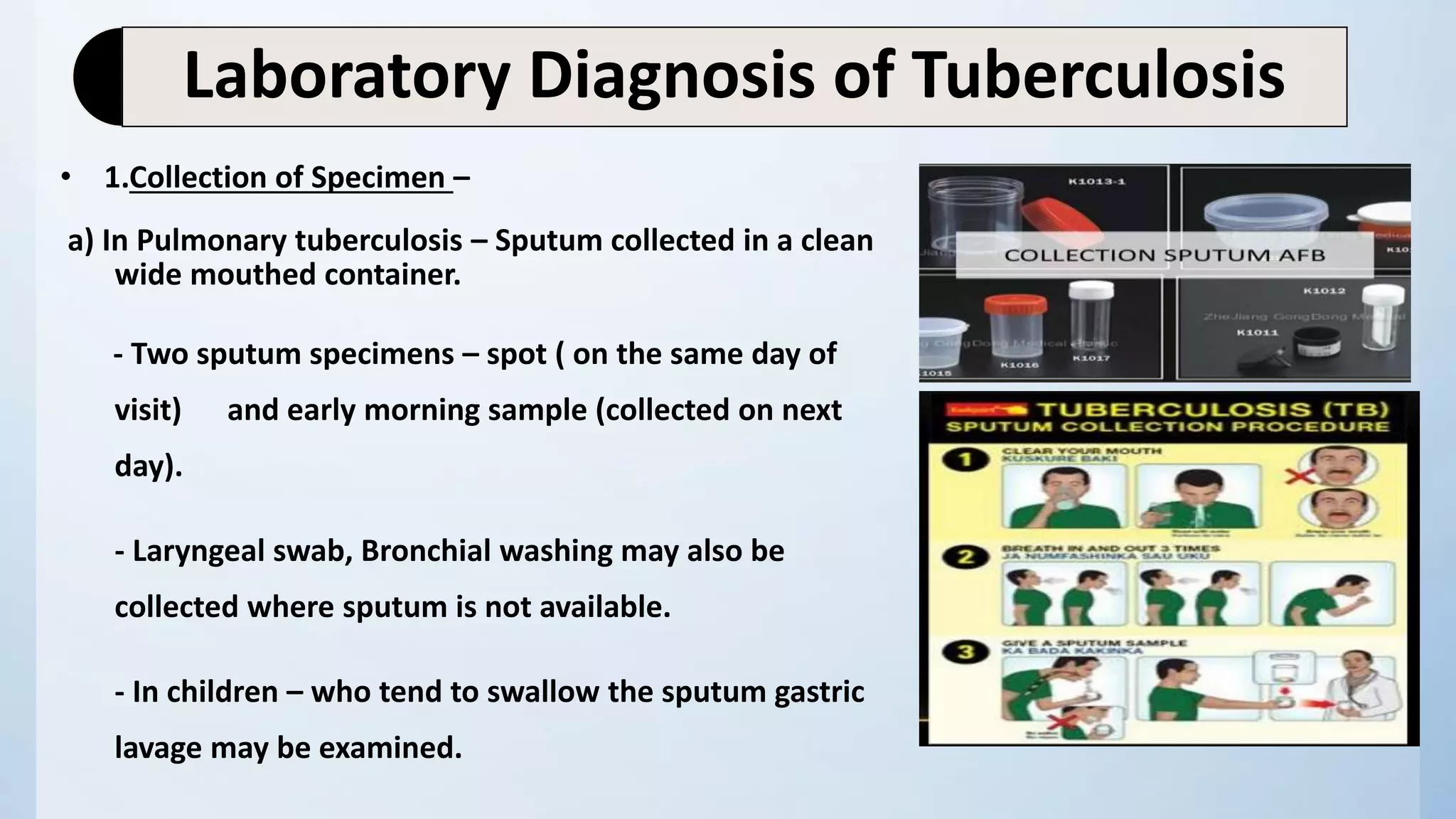 Laboratory diagnosis of tuberculosis pract. | PPTX