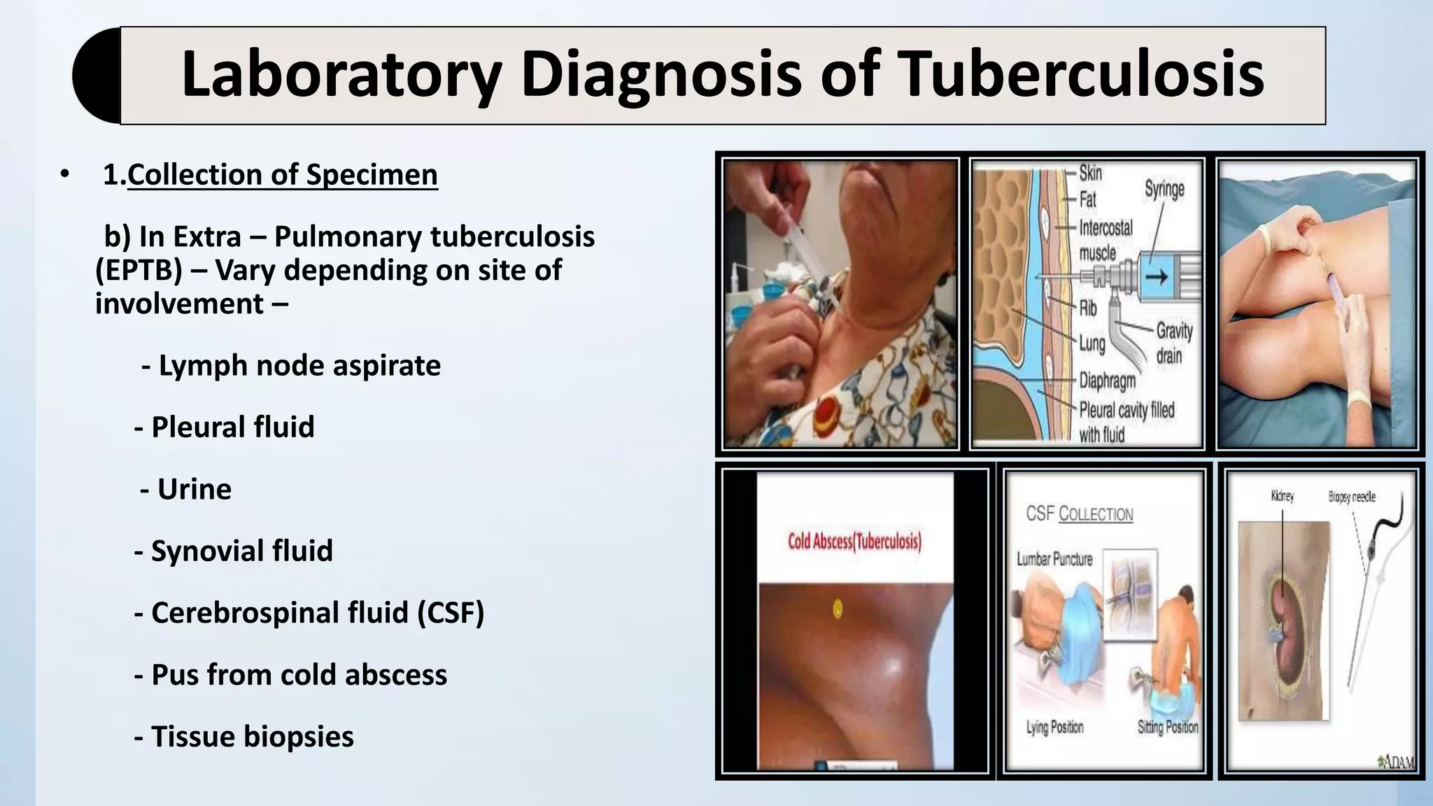 Laboratory diagnosis of tuberculosis pract. | PPTX