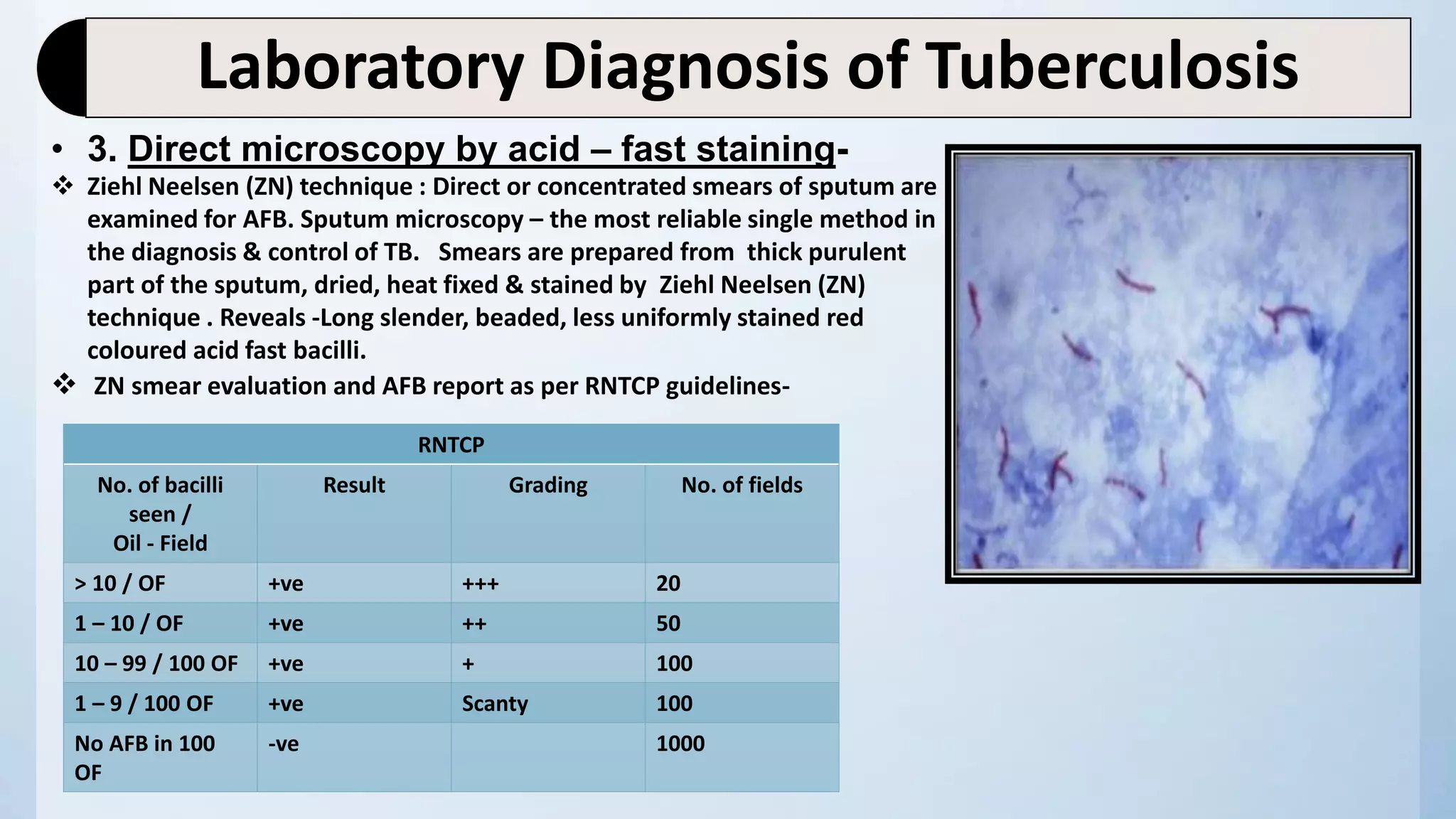 Laboratory diagnosis of tuberculosis pract. | PPTX