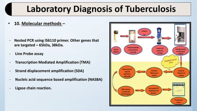 Laboratory diagnosis of tuberculosis pract. | PPT