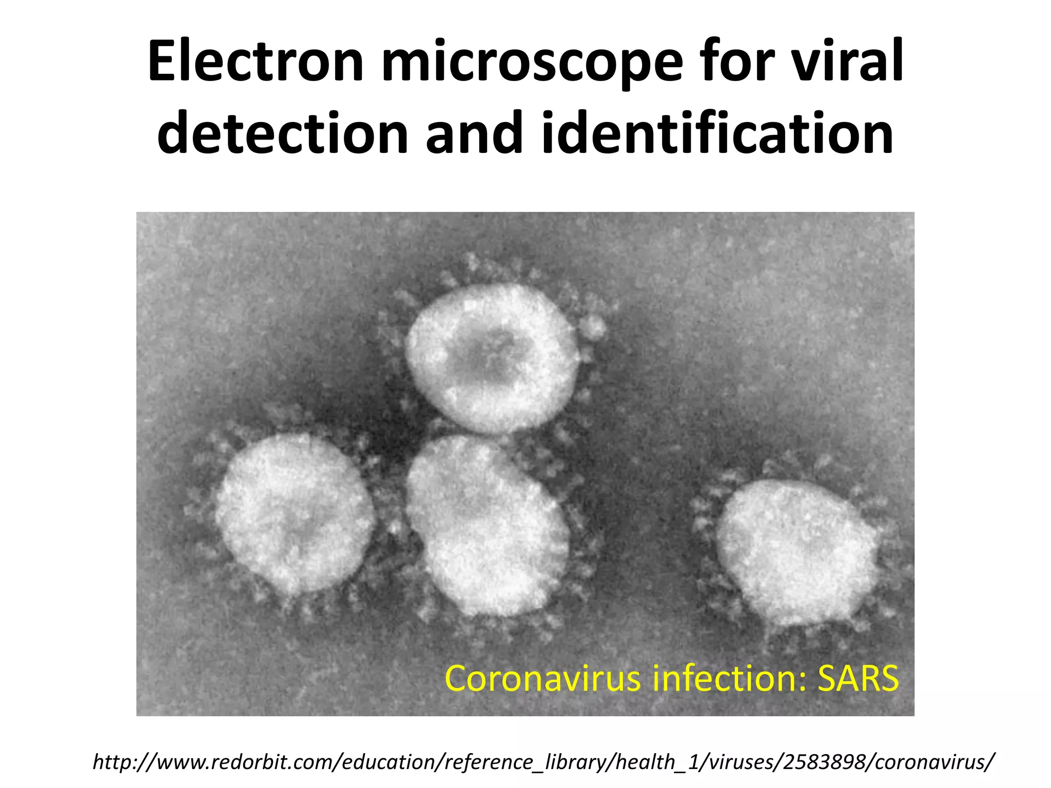 Laboratory diagnosis of viral infection | PPT