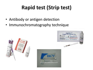 Laboratory diagnosis of viral infection | PPT