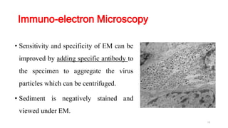 LABORATORY DIAGNOSIS OF VIRAL INFECTION.pptx