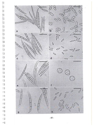 Fusarium Oxysporum Conidia