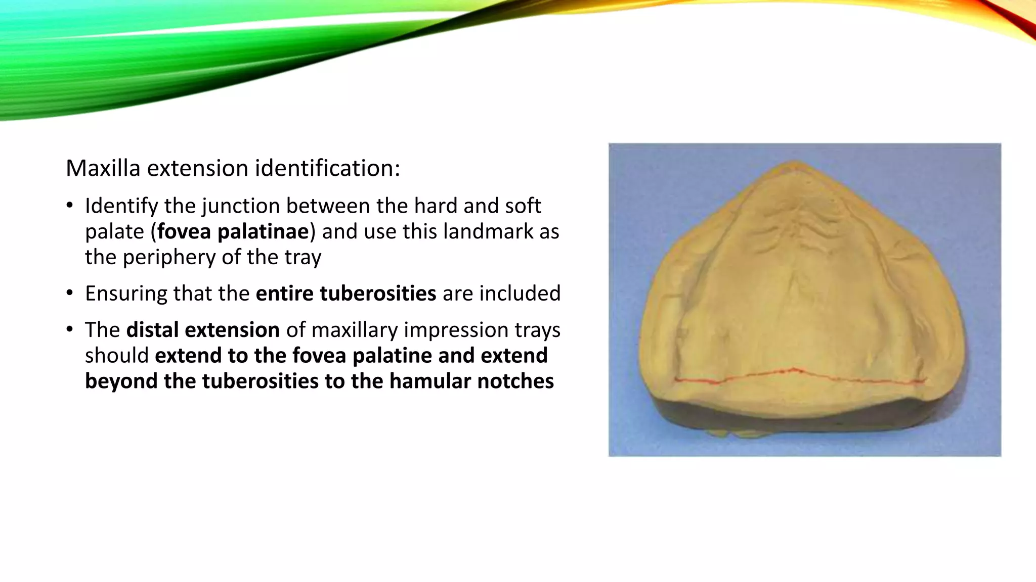 special tray in complete denture | PPTX
