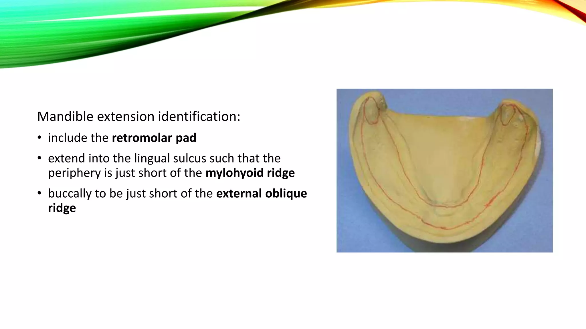 special tray in complete denture | PPTX