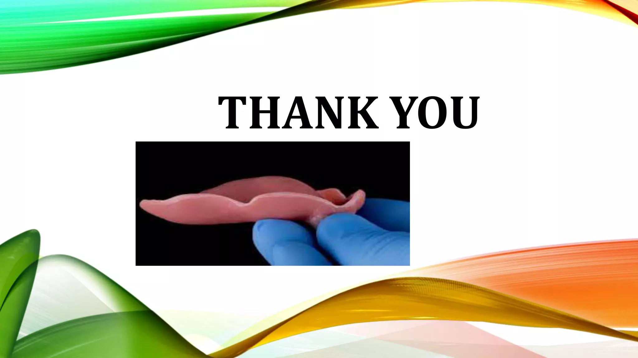 special tray in complete denture | PPTX