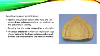 special tray in complete denture | PPTX