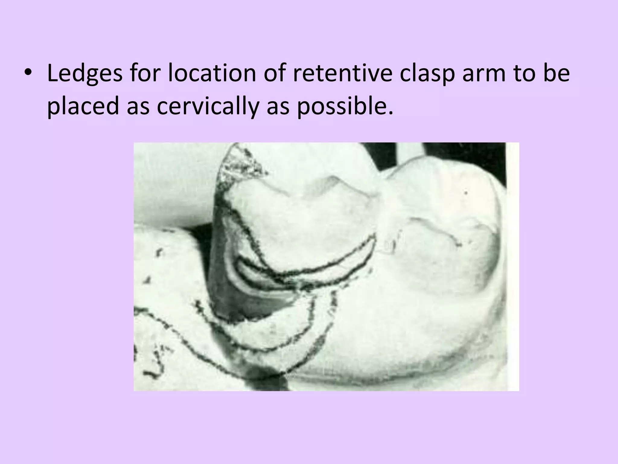 Laboratory procedure in rpd fabrication | PPTX