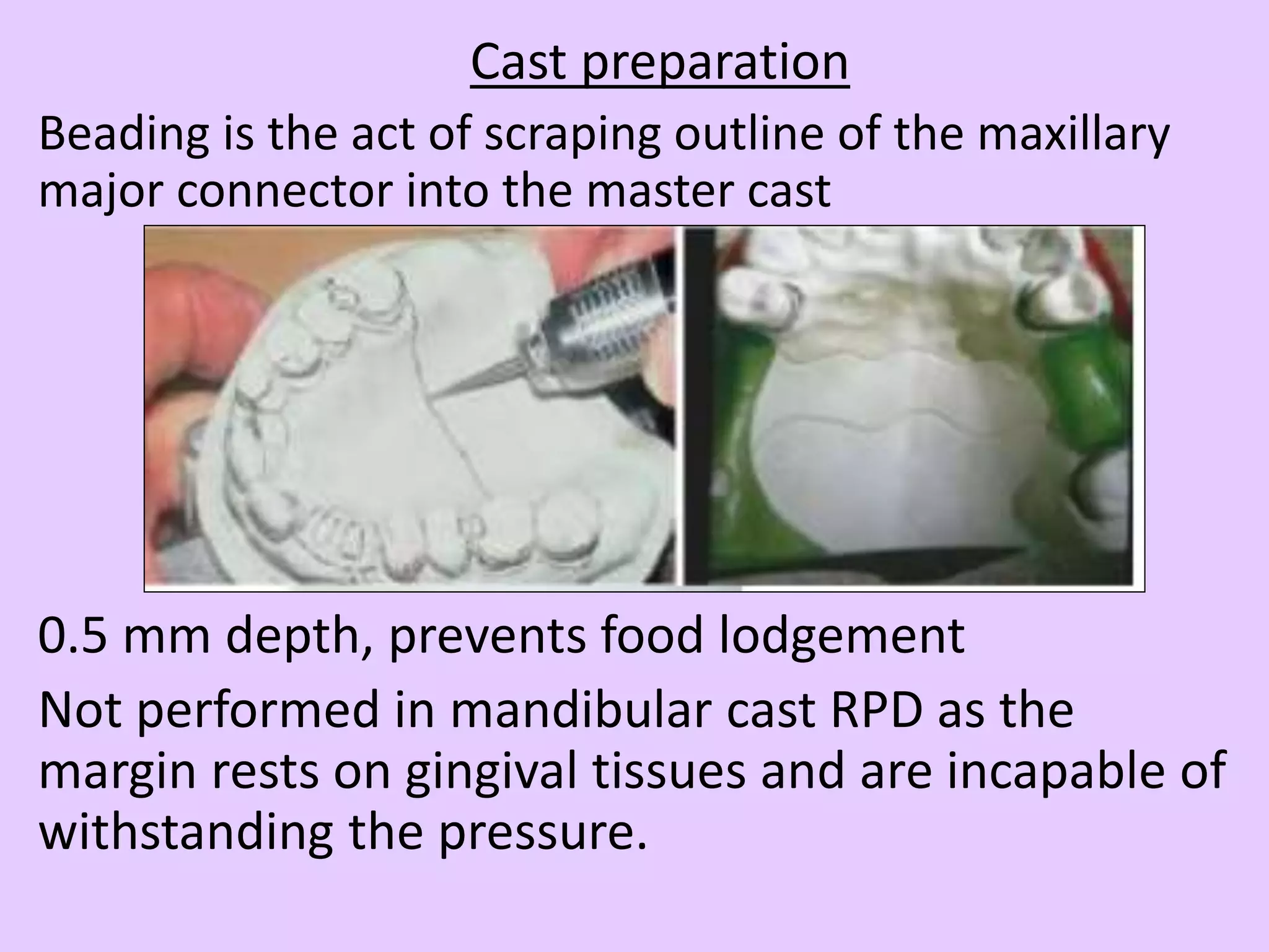 Laboratory procedure in rpd fabrication | PPTX