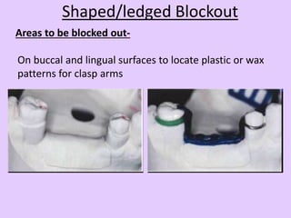 Laboratory procedure in rpd fabrication | PPTX