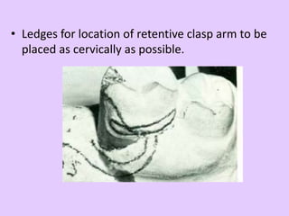 Laboratory procedure in rpd fabrication | PPTX