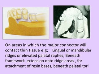 Laboratory procedure in rpd fabrication | PPTX