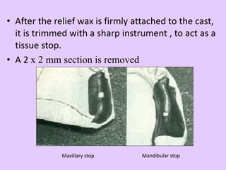 Laboratory procedure in rpd fabrication | PPTX