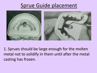 Laboratory procedure in rpd fabrication | PPTX