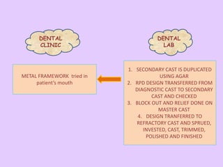 Laboratory procedure in rpd fabrication | PPTX