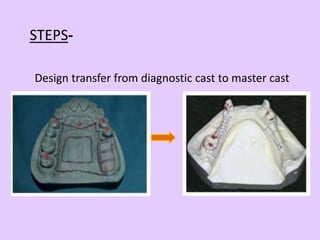 Laboratory procedure in rpd fabrication | PPTX