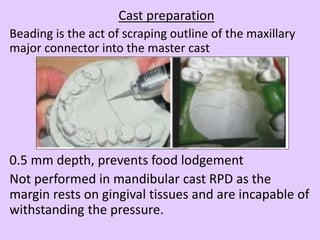 Laboratory procedure in rpd fabrication | PPTX